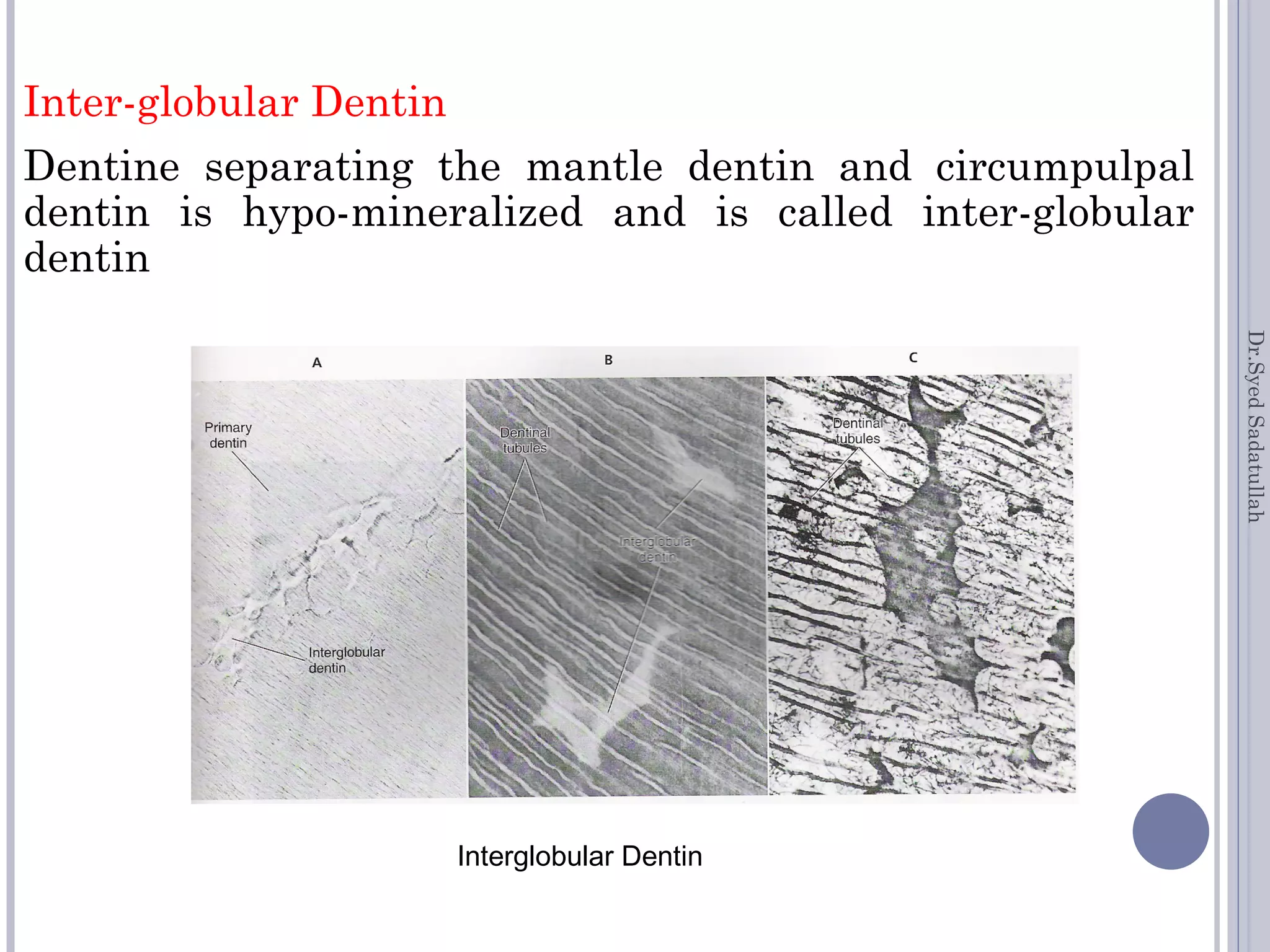 Dentin | PPT