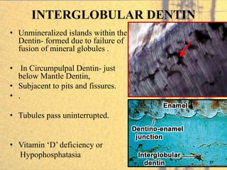 Interglobular Dentin