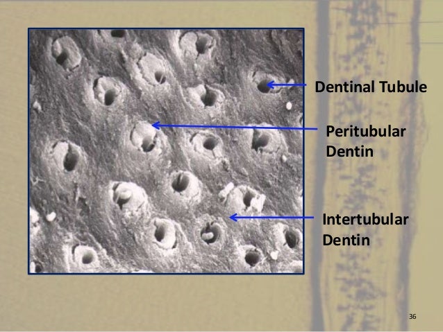 Dentin