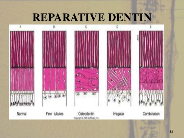 Dentin