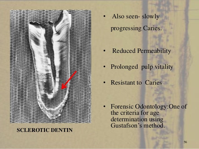 Dentin