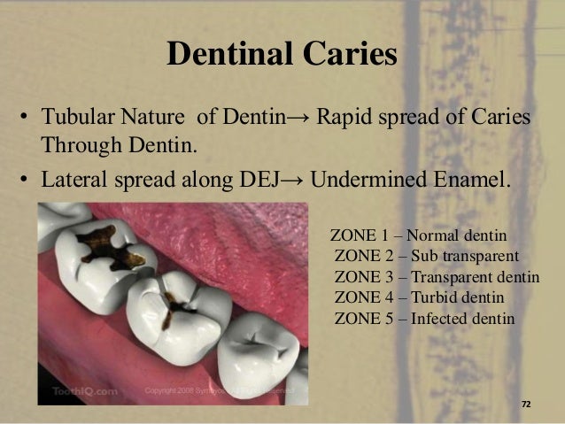 Dentin