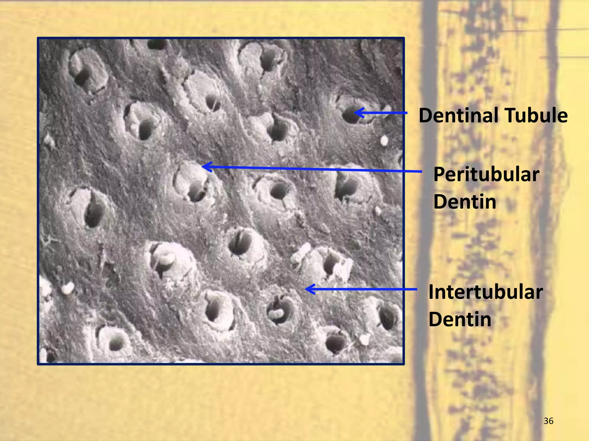 Dentin | PPTX