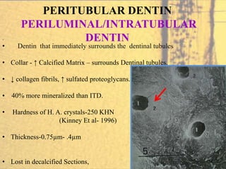 Peritubular Dentin
