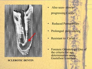 Sclerotic Dentin
