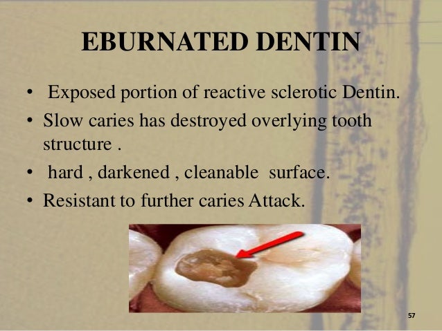 Dentin