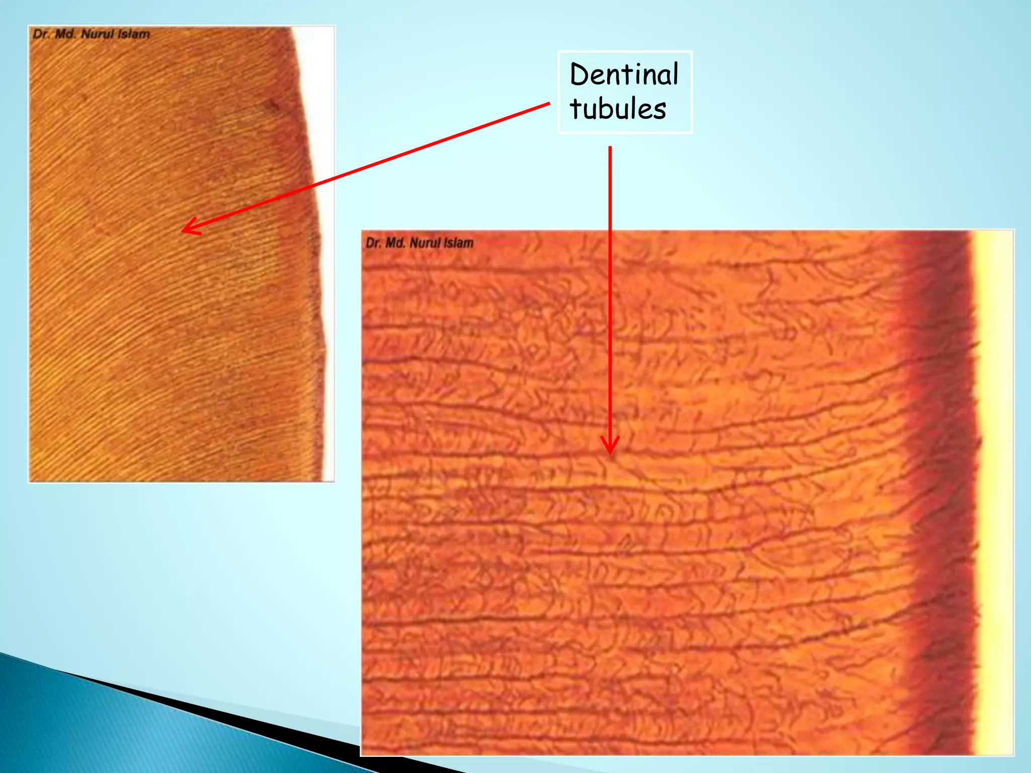 Dentin -- Structural aspect | PPT