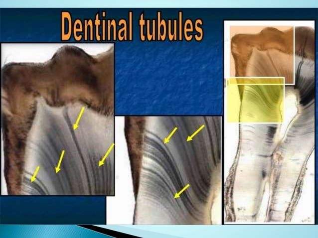 Dentin -- Structural aspect | PPT
