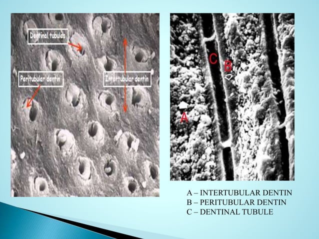 Dentin -- Structural aspect | PPT