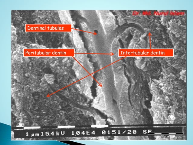 Dentin -- Structural aspect | PPT