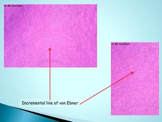 Incremental Lines Of Von Ebner