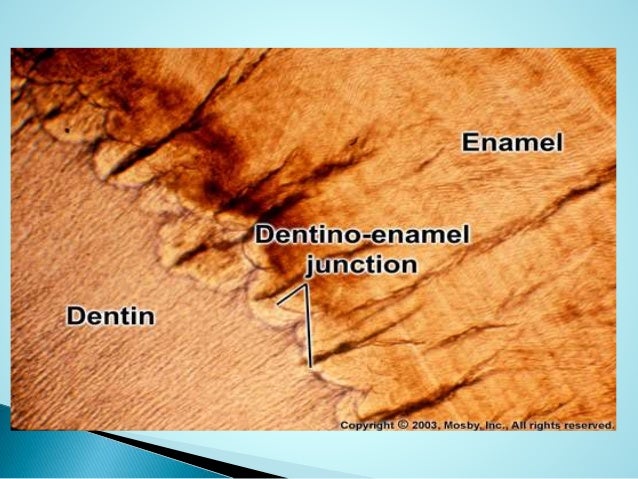 Dentin -- Structural aspect