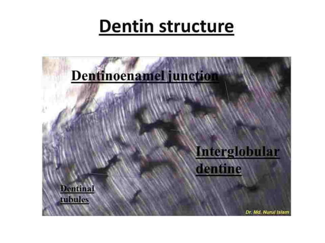 Dentin | PPTX | Dental Health | Diseases and Conditions