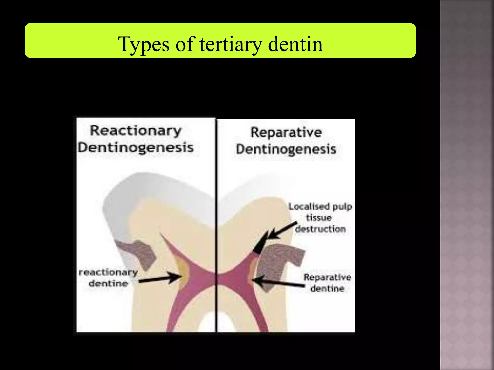 Dentin | PPTX | Dental Health | Diseases and Conditions