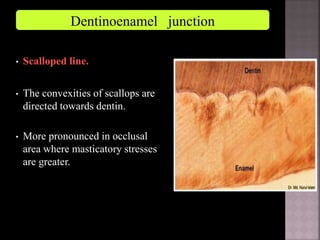 Dentinoenamel Junction