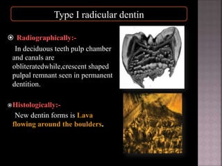 Dentin | PPT