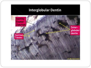 Dentin | PPTX