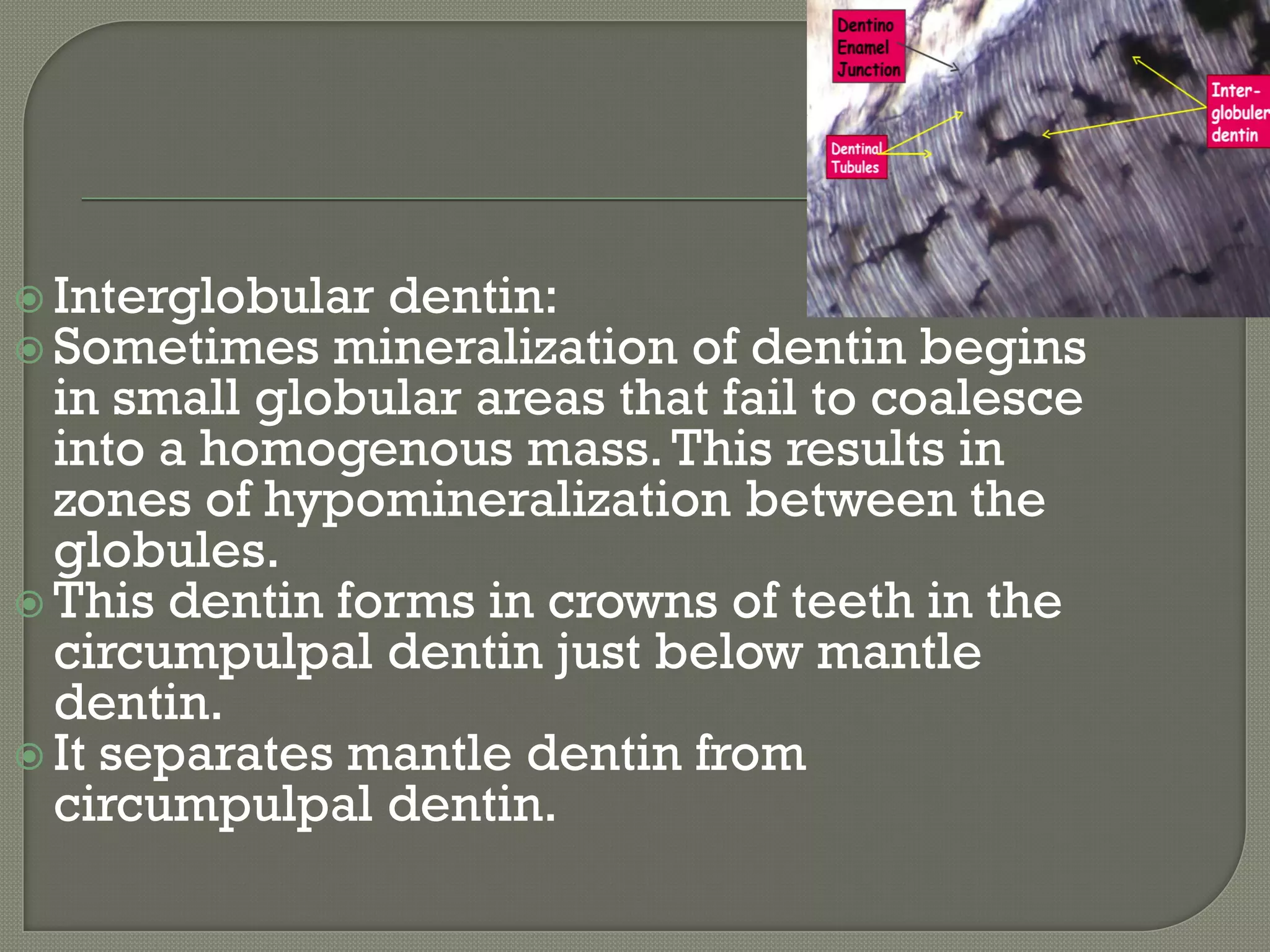 Dentin | PDF