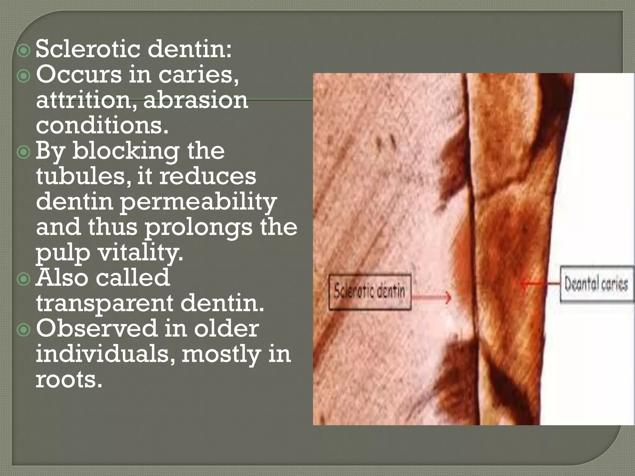 Dentin | PDF