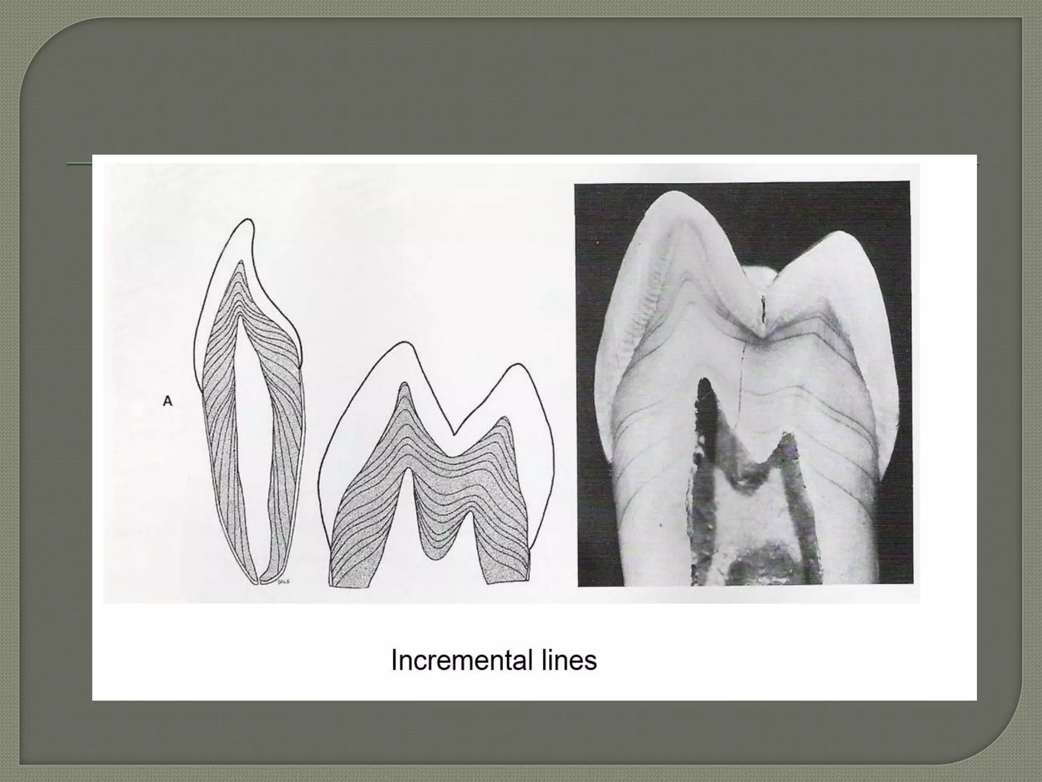 Dentin | PDF