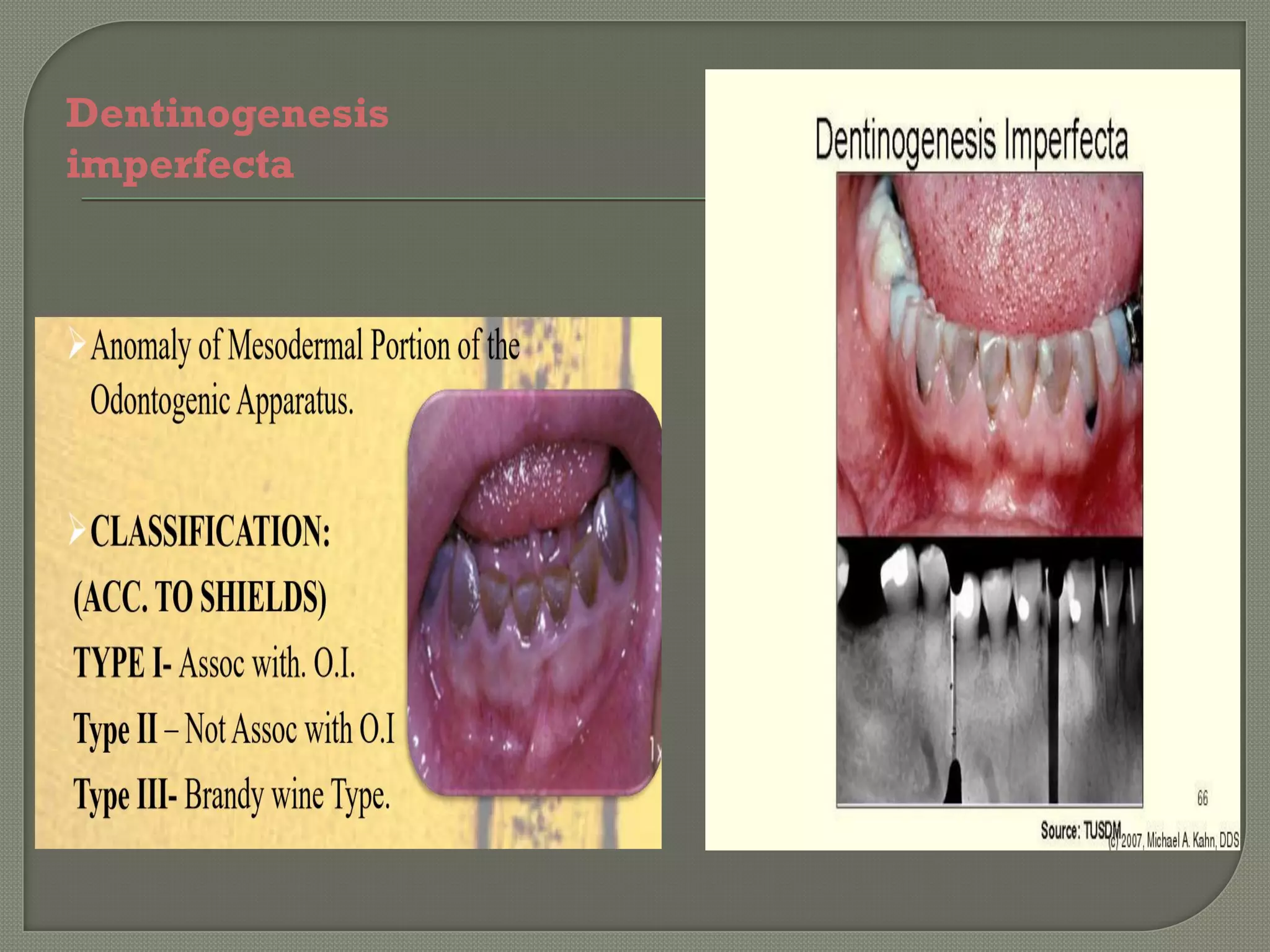 Dentin | PDF
