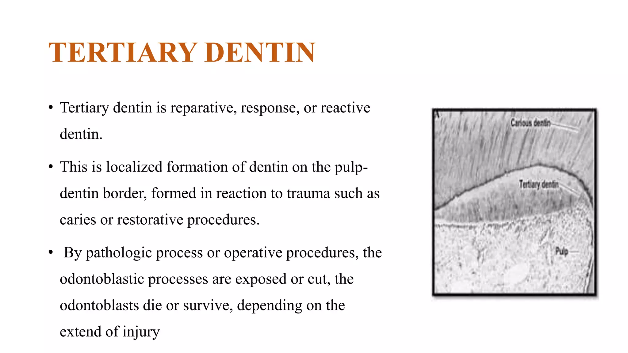 DENTIN.pptx