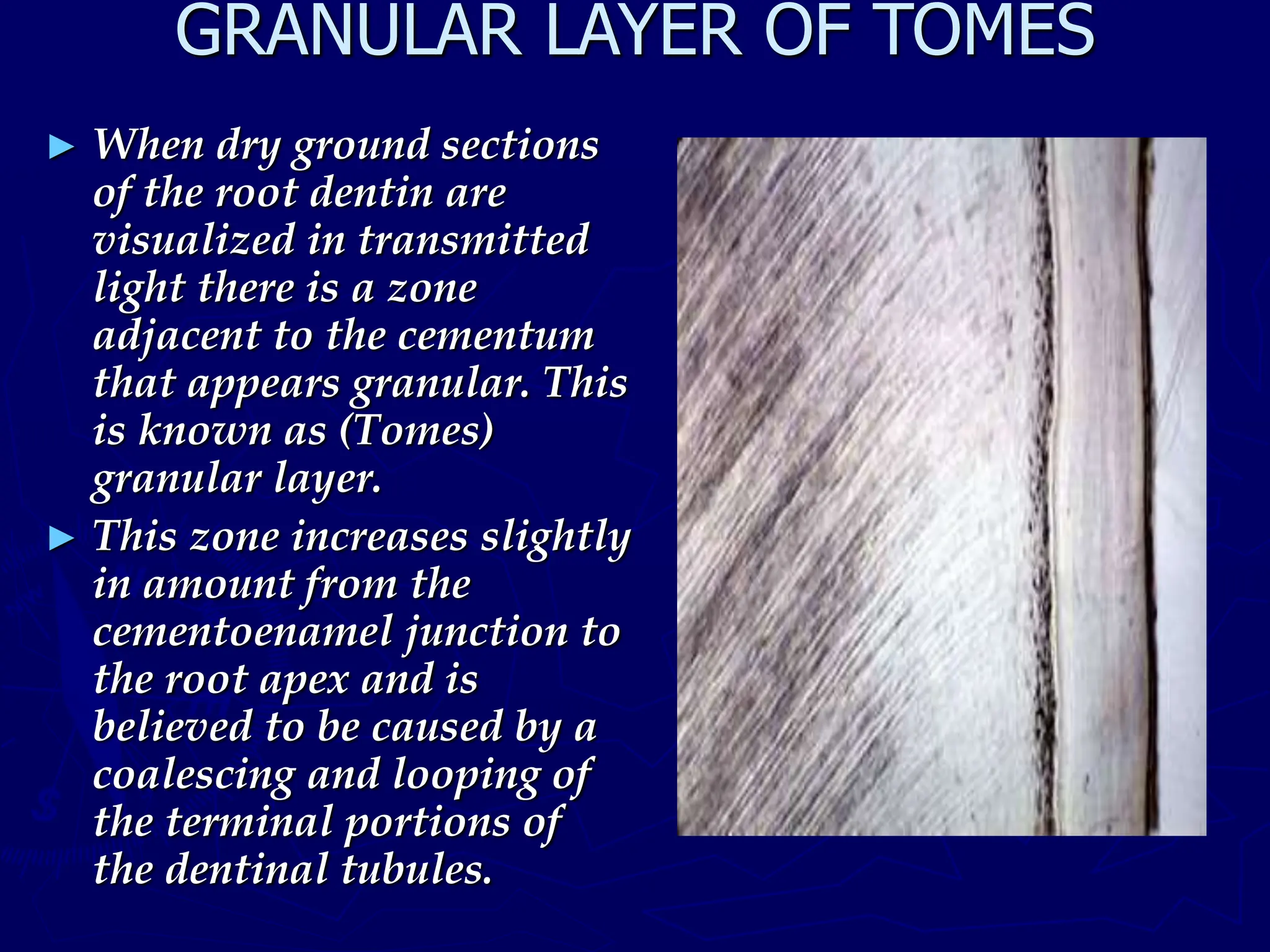 middle layer of tooth the dentin which has yellowish in color | PPT