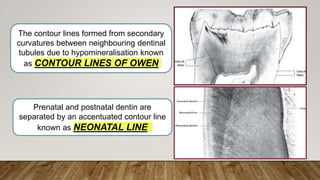 DENTIN seminar DENTIN seminar DENTIN seminar | PPTX