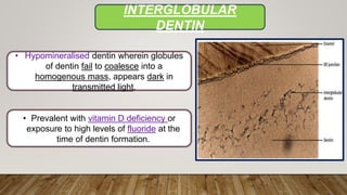 DENTIN seminar DENTIN seminar DENTIN seminar | PPTX