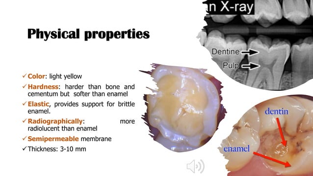 dentin full chapter lecture' oral histology.pdf | Dental Health ...