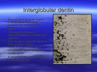 Dentin is a part of tooth. has a mojor role in the tooth structure and ...