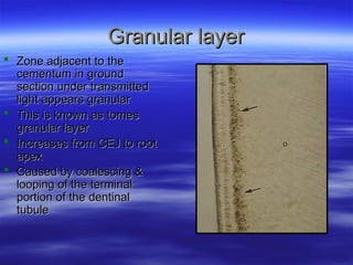 Dentin is a part of tooth. has a mojor role in the tooth structure and ...