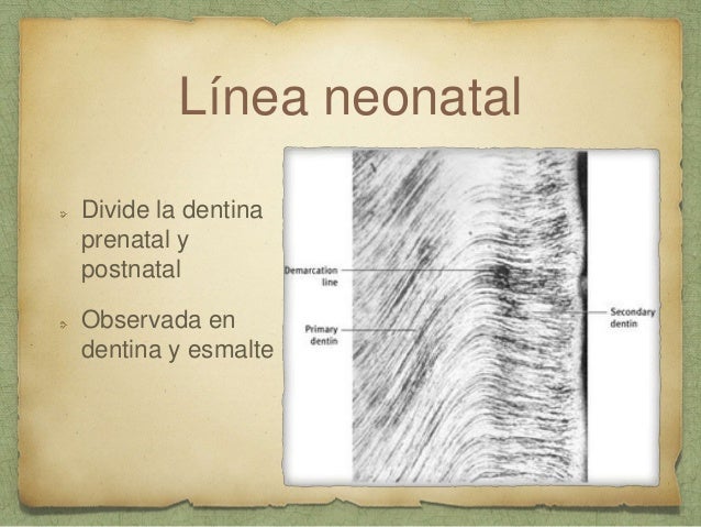 Histología de la dentina