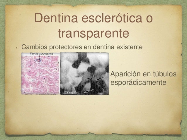 Histología de la dentina