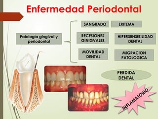 enfermedad periodontal, etiologia, .pptx