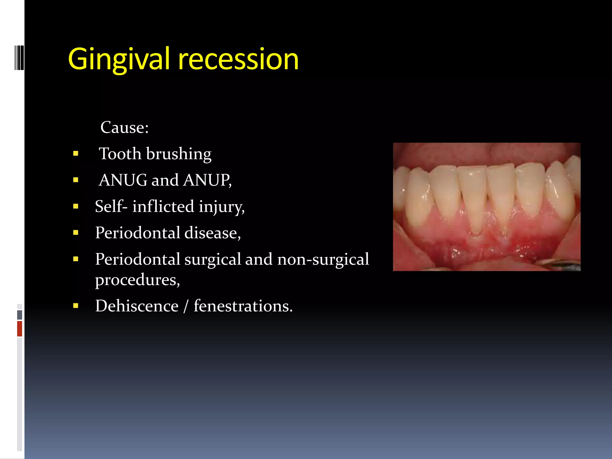 Dentinal hypersensitivity | PPTX