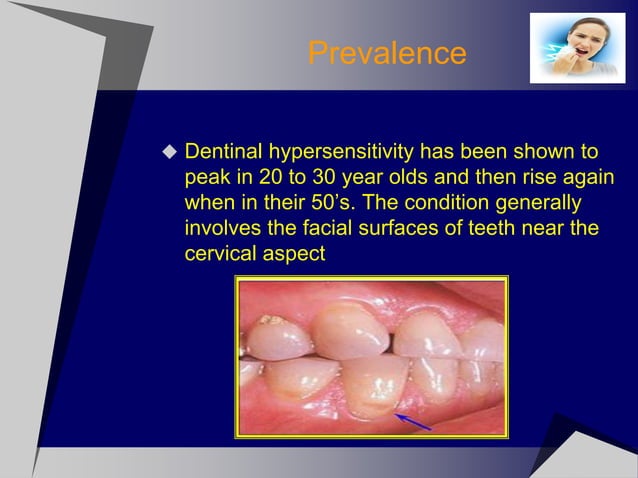 Dentinal hypersensitivity.pdf