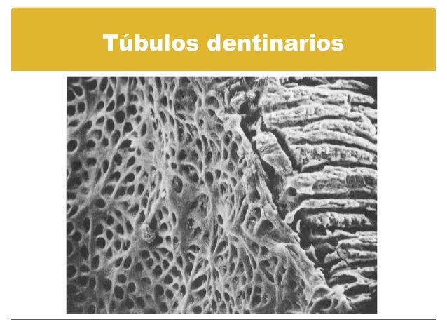 Dentina y dentinogénesis