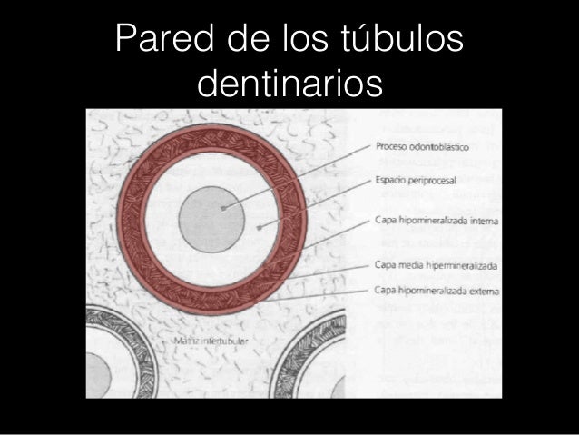 Dentina y dentinogénesis