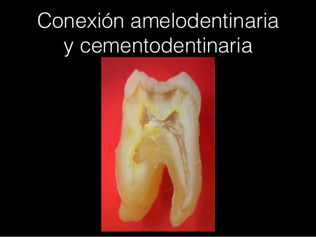 Dentina y dentinogénesis