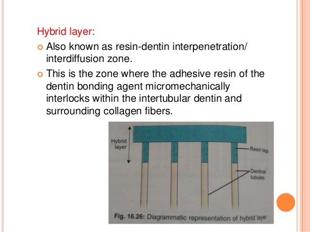 Dentin bonding agent