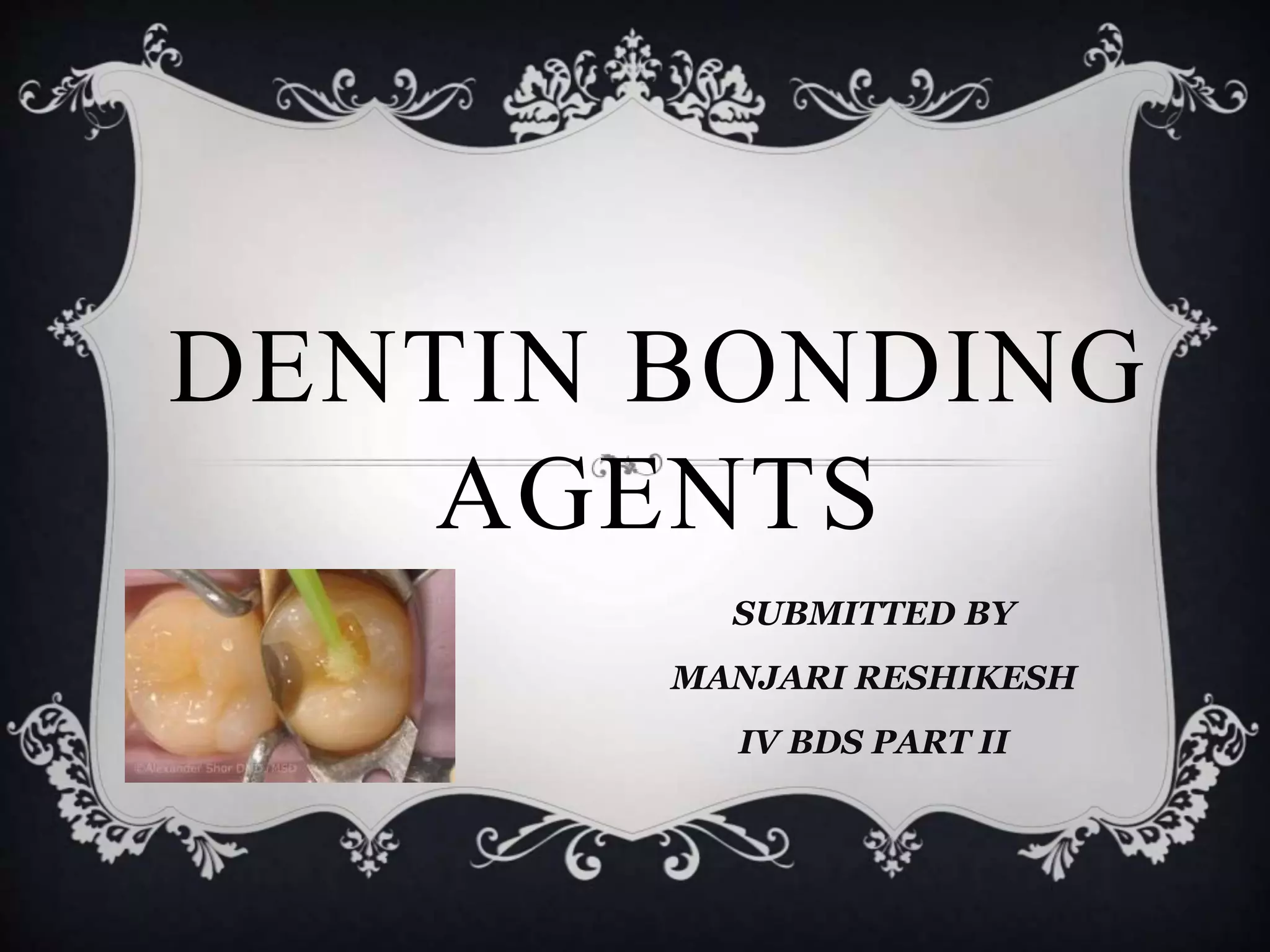 Dentin bonding agents | PPTX