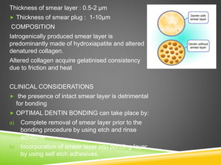 Dentin bonding agents | PPTX