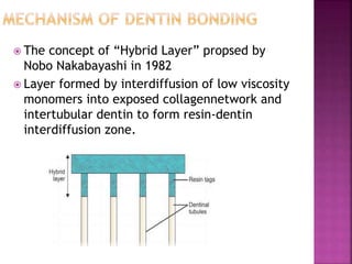 Dentin bonding agents | PPTX
