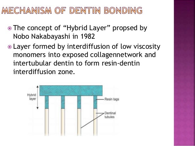 Dentin bonding agents