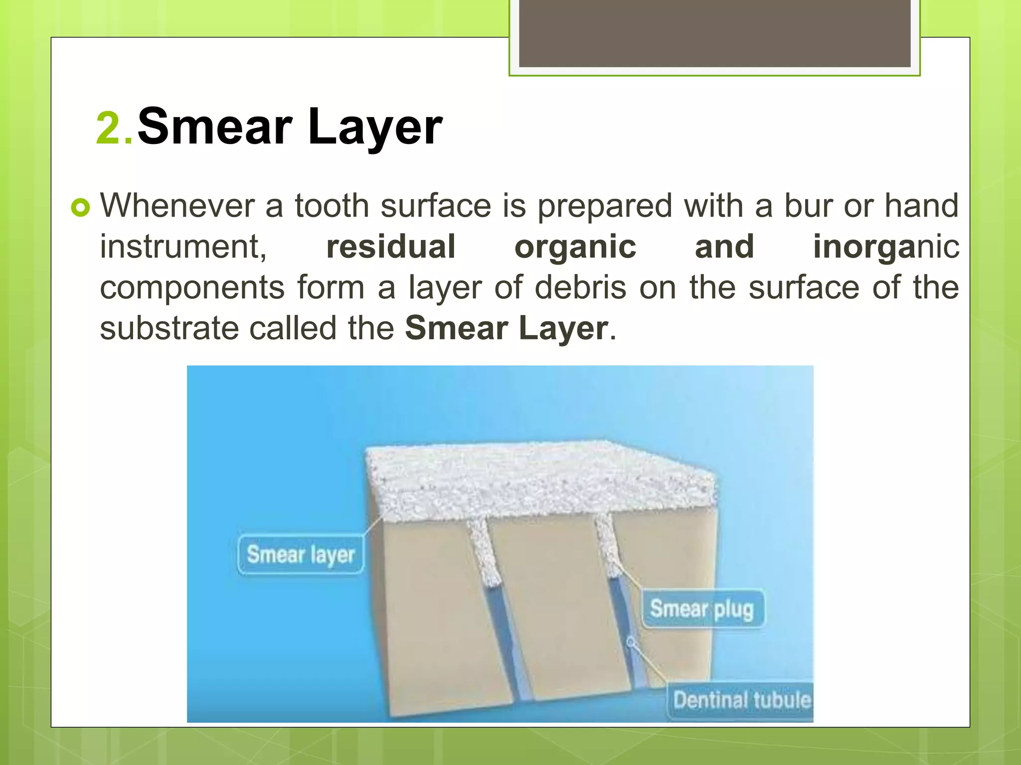 Dentin bonding agents | PPTX