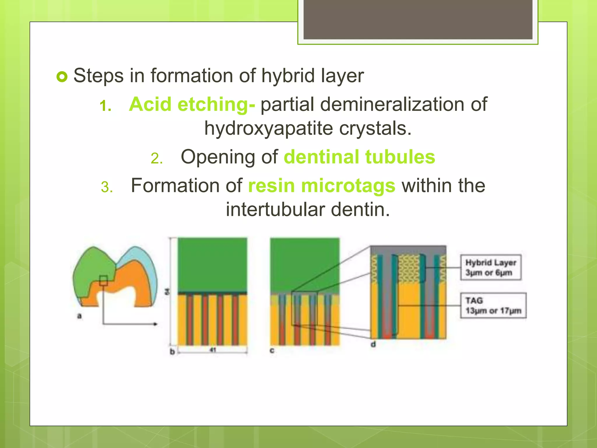 Dentin bonding agents | PPTX