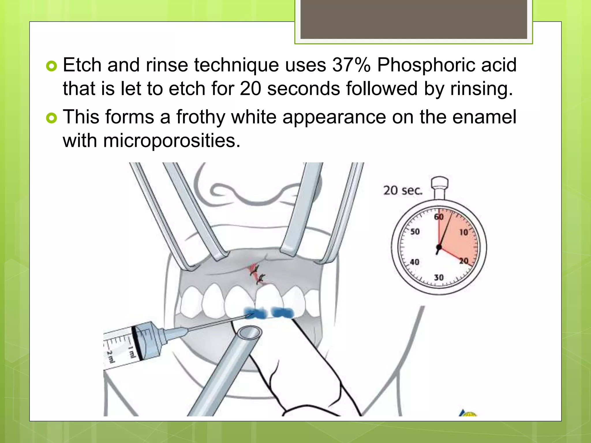 Dentin bonding agents | PPTX