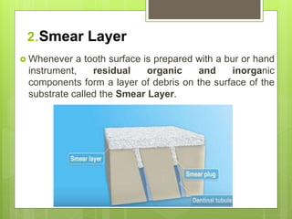 Dentin bonding agents | PPTX