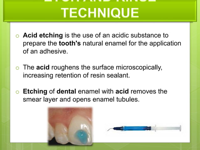 Dentin bonding agents | PPTX